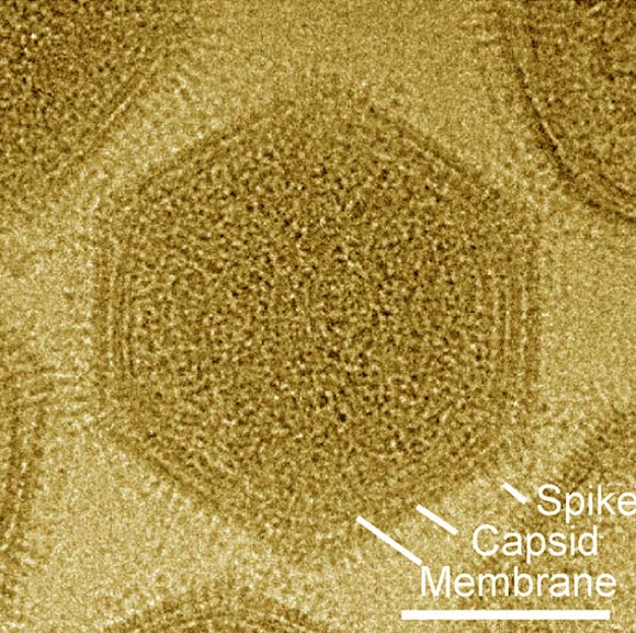 Medusavirus: Newly-Discovered Giant Virus Turns Its Hosts into ‘Stone ...