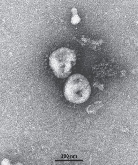 Newly-Identified Coronavirus 2019-nCoV: Here’s What You Need to Know ...